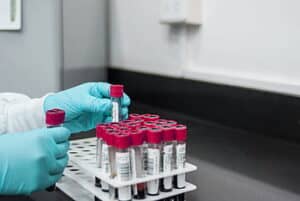 Do UFC Fighters Get Drug Tested? – Fully Explained Here – MMACHANNEL